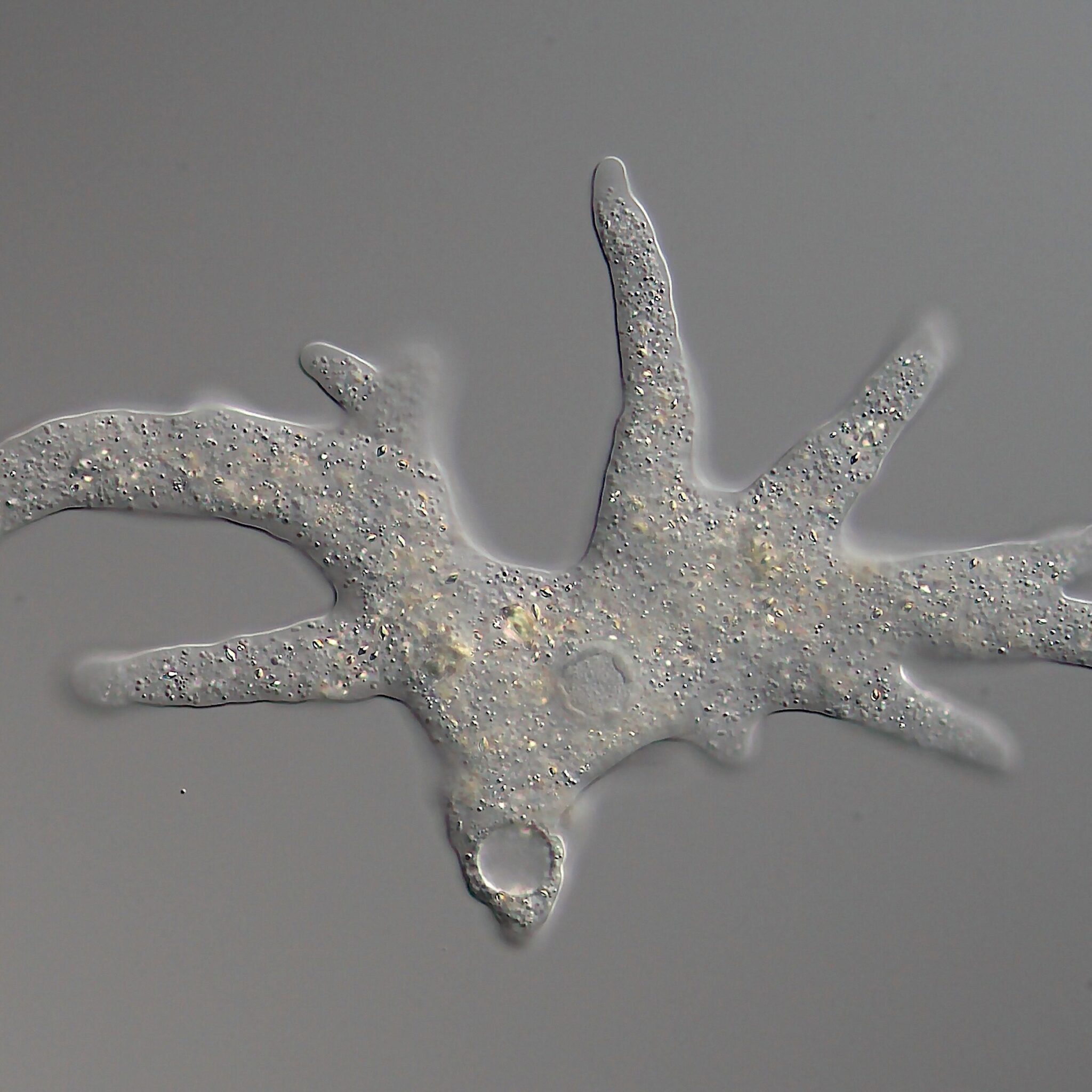 Amoeba proteus- Nutrition, Respiration, Excretion, Osmoregulation