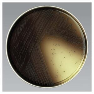 Bile Esculin Agar- Composition, Principle, Preparation