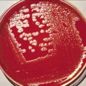 Bacillus anthracis - Biochemical Test