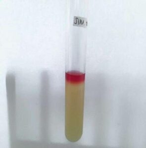 Proteus mirabilis - Biochemical Test
