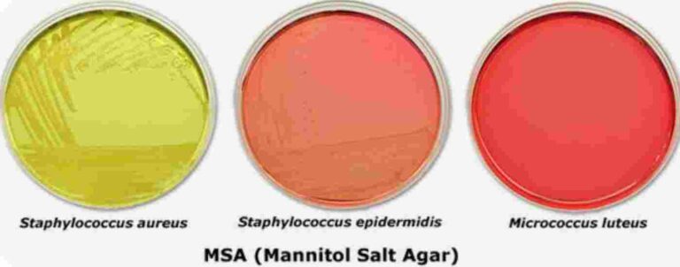 Staphylococcus aureus - Biochemical Test