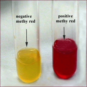 Proteus mirabilis - Biochemical Test