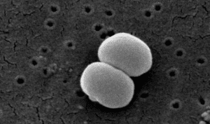 Biochemical Test of Staphylococcus epidermidis