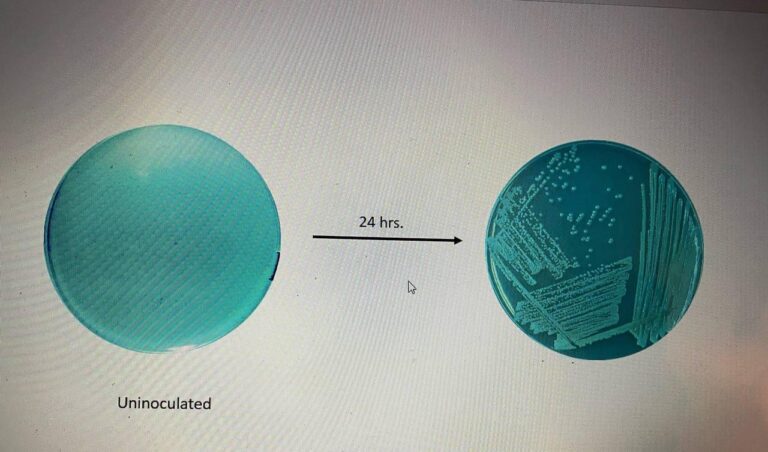 Staphylococcus aureus - Biochemical Test Staphylococcus aureus - Biochemical Test
