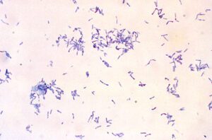 Corynebacterium diphtheriae