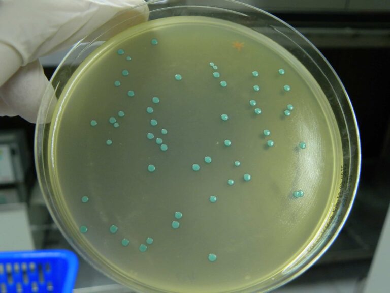 Listeria monocytogenes biochemical test