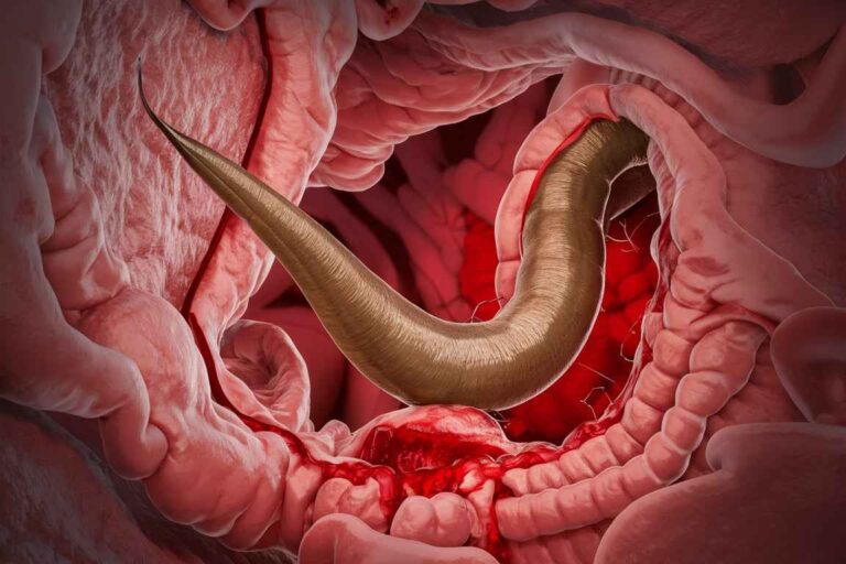 Hookworm infection: life cycle, transmission