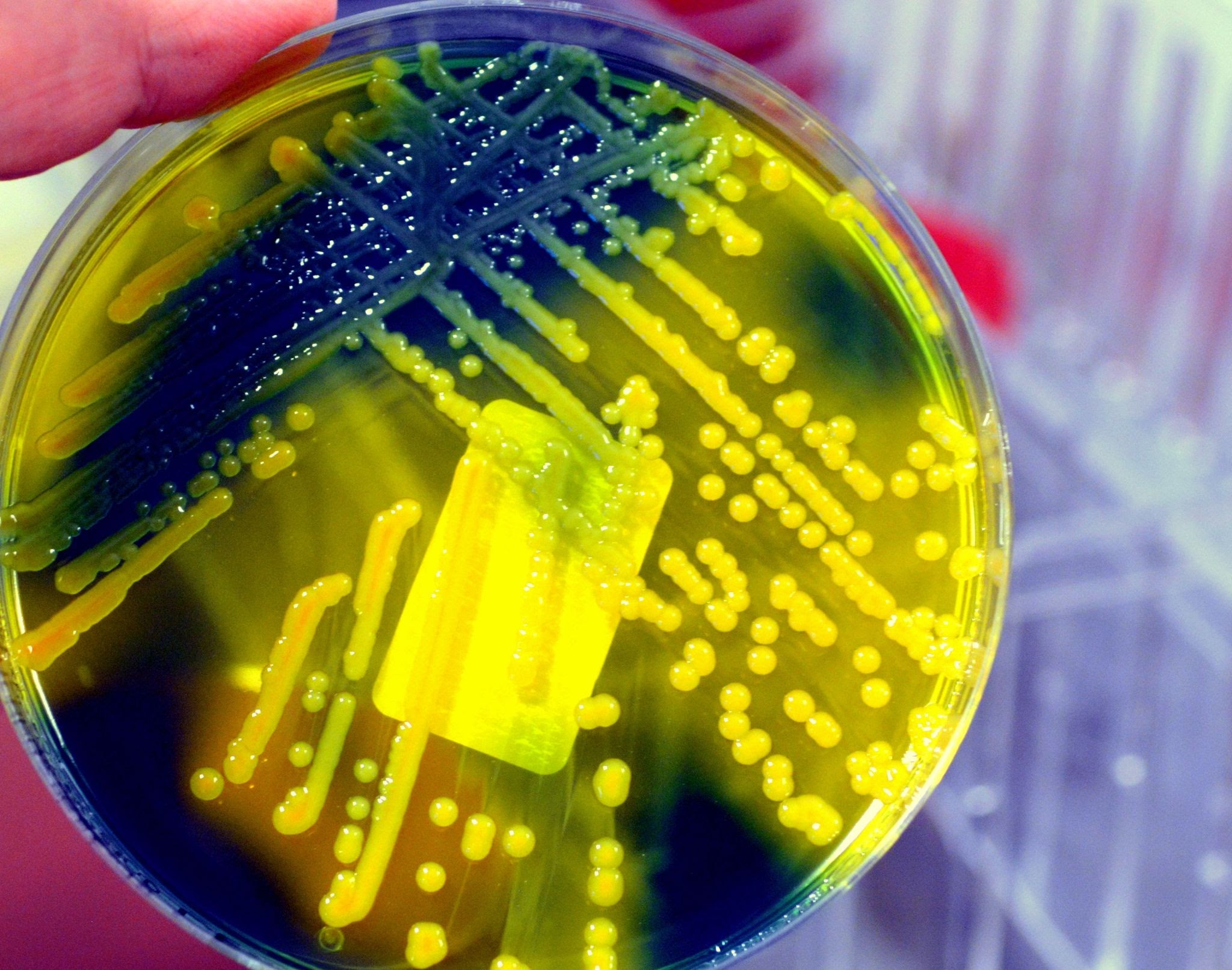 Salmonella-Shigella Agar test: Principle, Composition,.