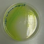 Cetrimide agar: composition, preparation and uses - Best...