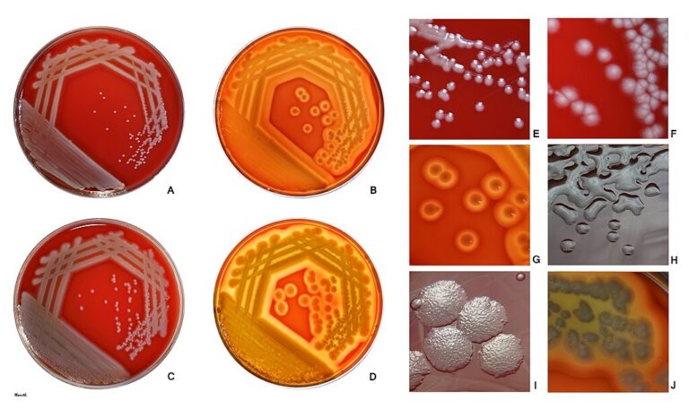 Cetrimide agar: composition, preparation and uses - Best...