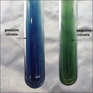Citrate utilization test: objective, principle, procedure...