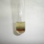 Molisch Test: Objectives, Principle, Reagents, Procedure..