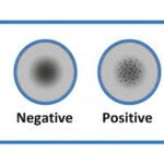 VDRL test: Principle, Procedure, Result interpretation...