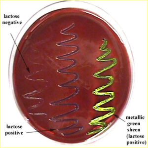 EMB Agar - Best Biology Notes, Reference, Articles