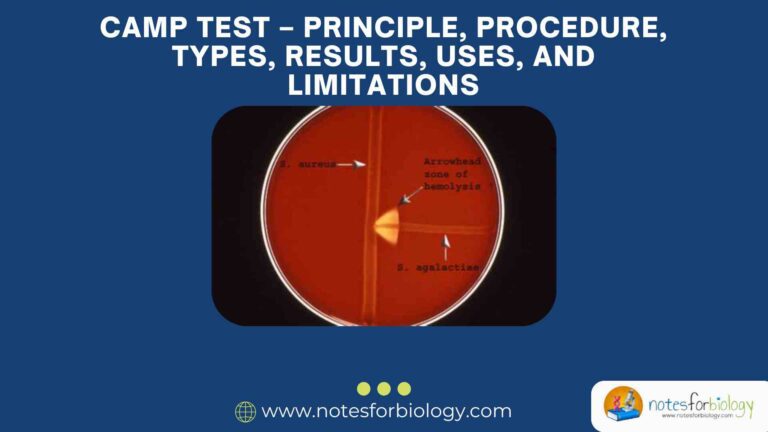 CAMP Test – Principle, Procedure, Types, Results, Uses Best