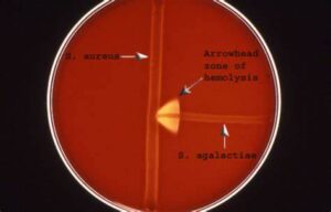 CAMP Test – Principle, Procedure, Types, Results, Uses Best