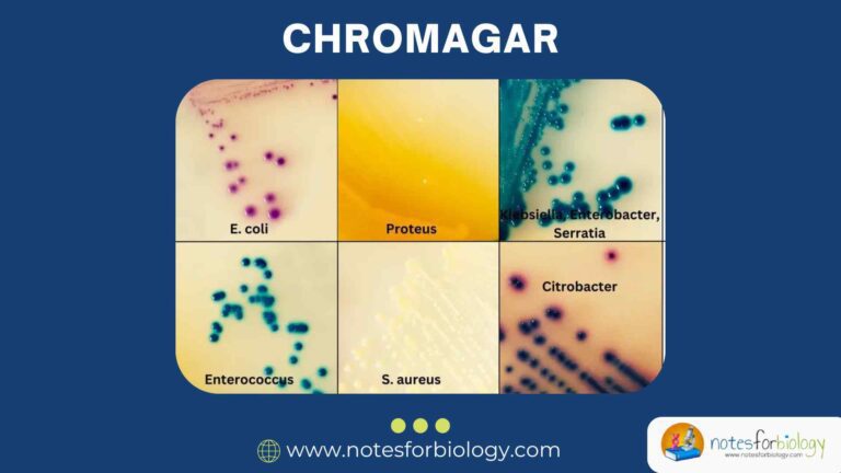 CHROMagar- Composition, Principle, Preparation, Result- Best