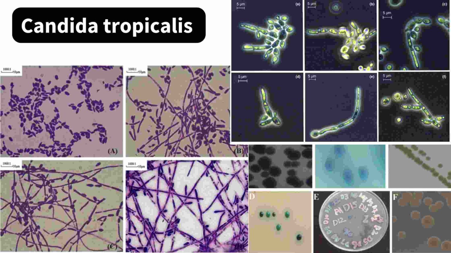 Candida tropicalis — Morphology, Habitat and Pathology