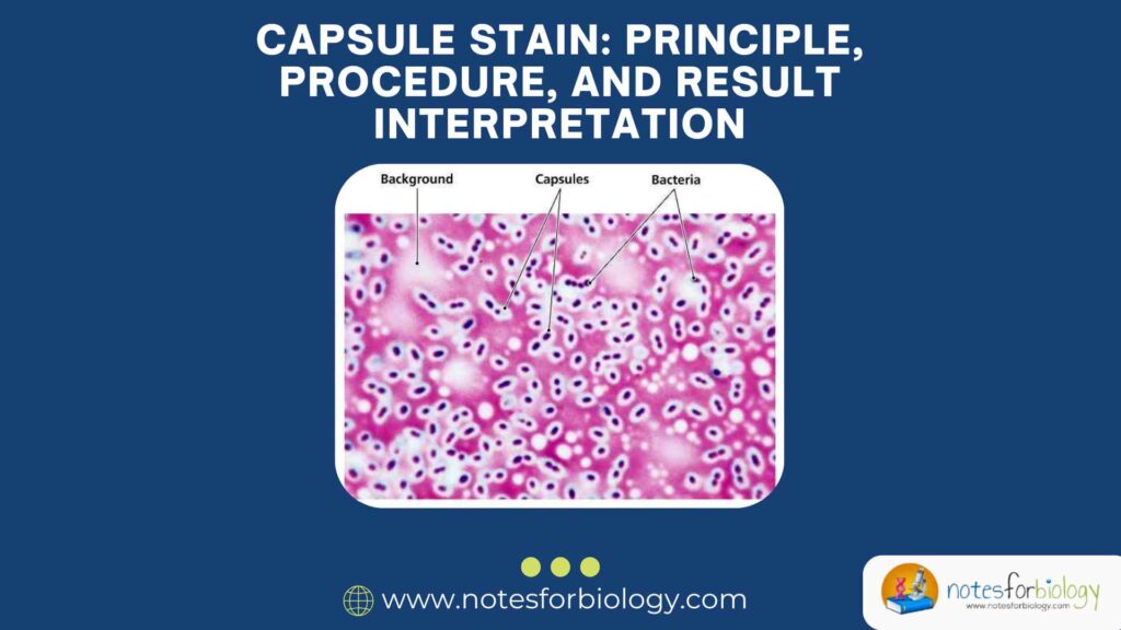 Capsule Stain: Principle, Procedure, and Result... Best