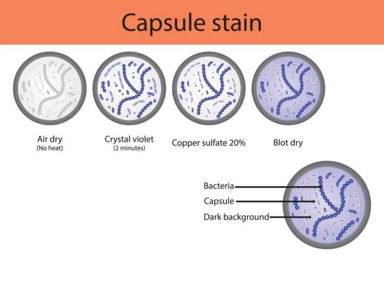 Capsule Stain: Principle, Procedure, and Result... Best