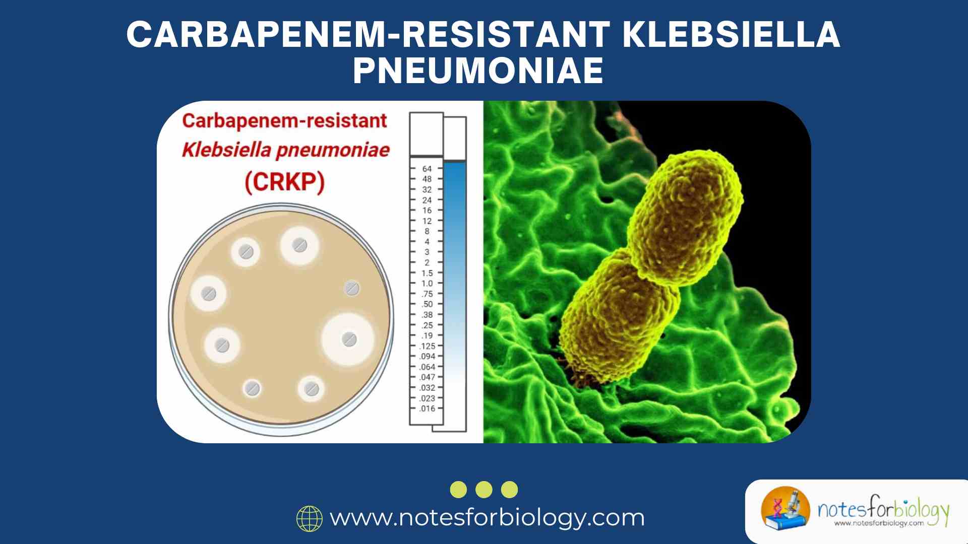 Carbapenem-Resistant Klebsiella pneumoniae (CRKP) - Best