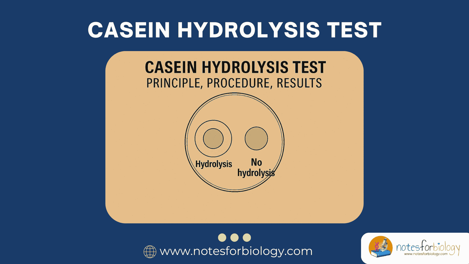 Casein Hydrolysis Test- Principle, Procedure, Results