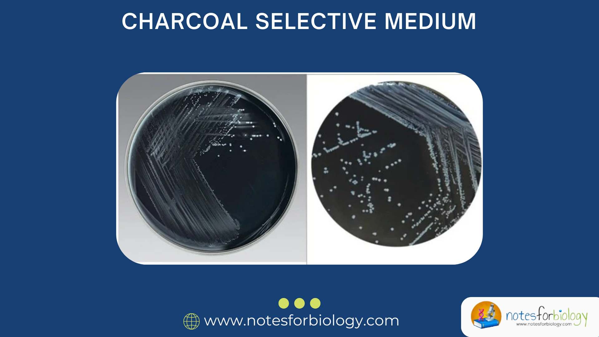 Charcoal Selective Medium - Best Biology Notes,...