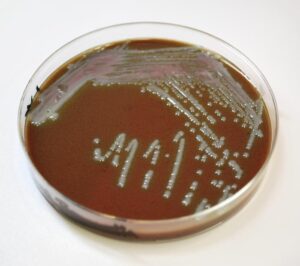 Chocolate Agar - Best Biology Notes, Reference, Articles