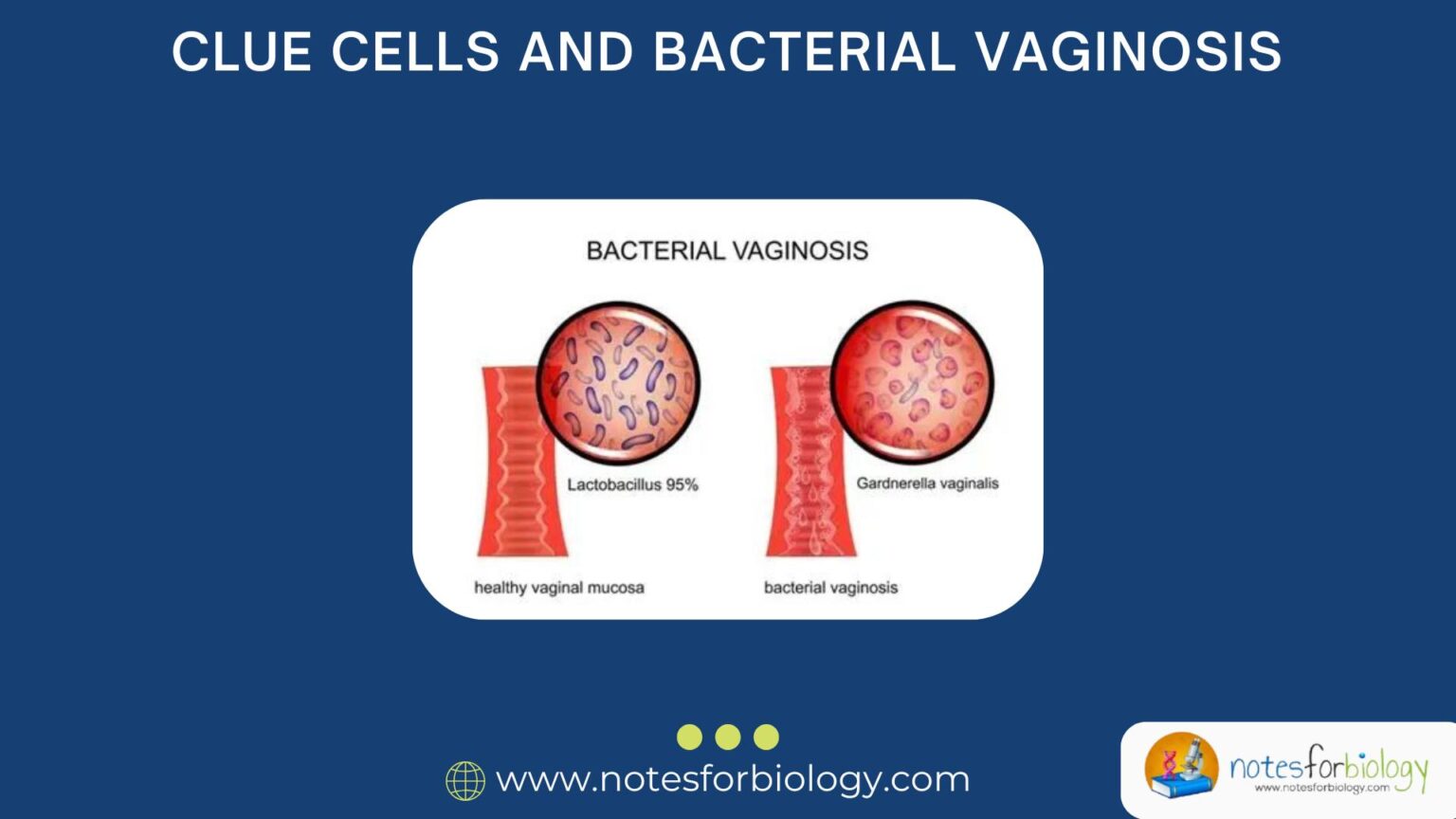 Clue Cells and Bacterial Vaginosis - Best Biology Notes,...