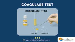 Coagulase Test- Principle, Procedure, Types, Result, Uses