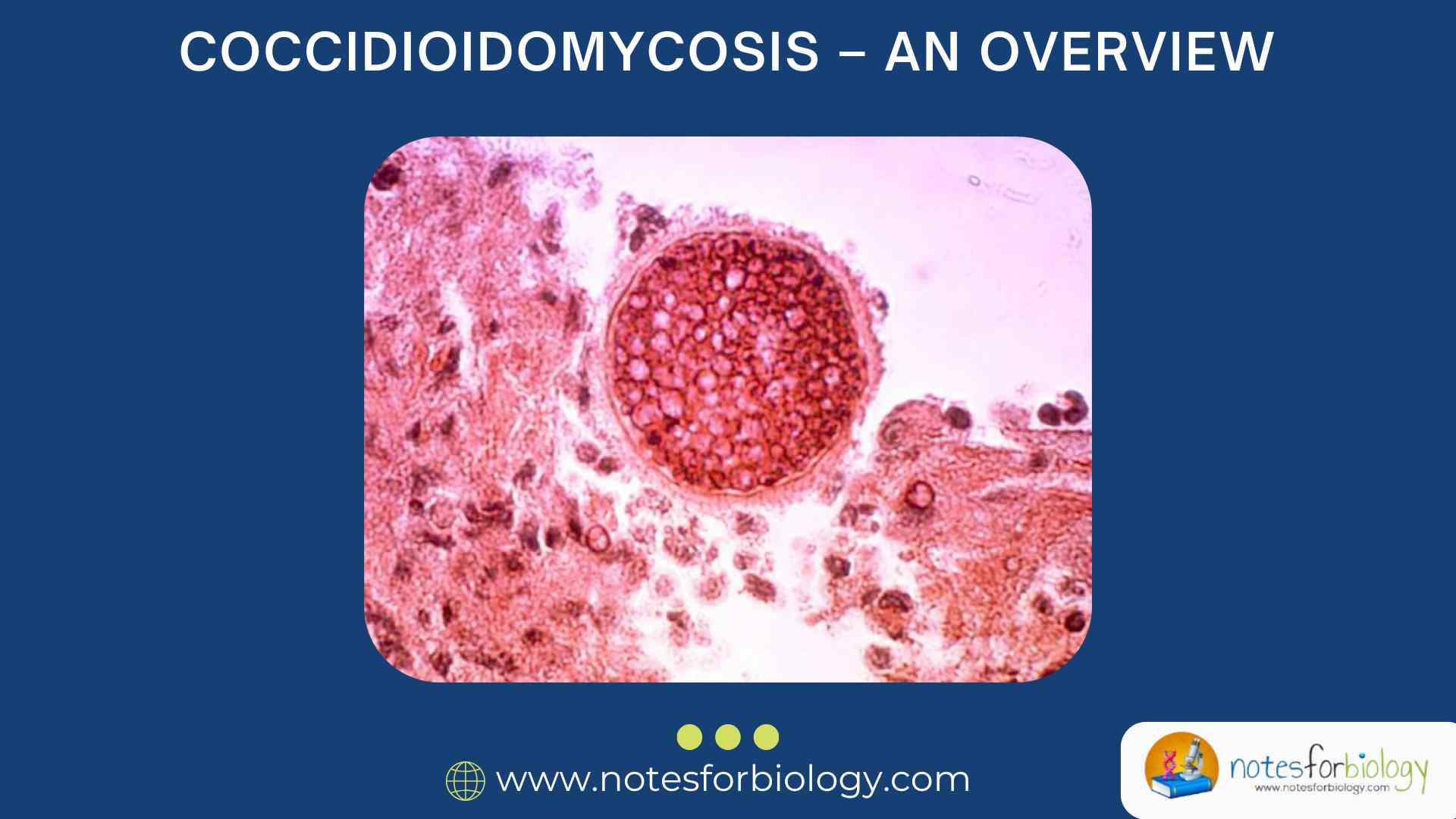 Coccidioidomycosis – An Overview - Best Biology Notes,...