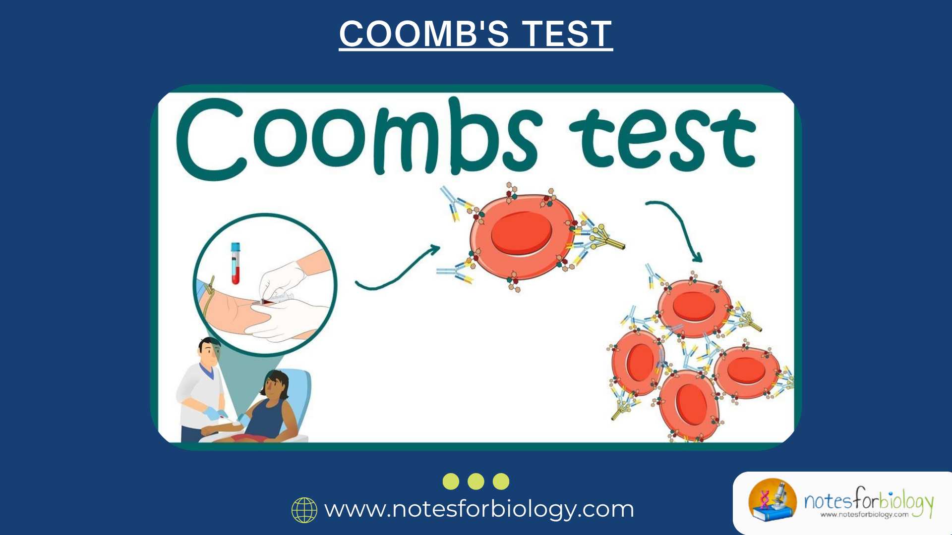 Coomb's Test - Best Biology Notes, Reference, Articles
