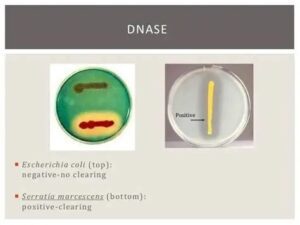 DNase Test - Best Biology Notes, Reference, Articles