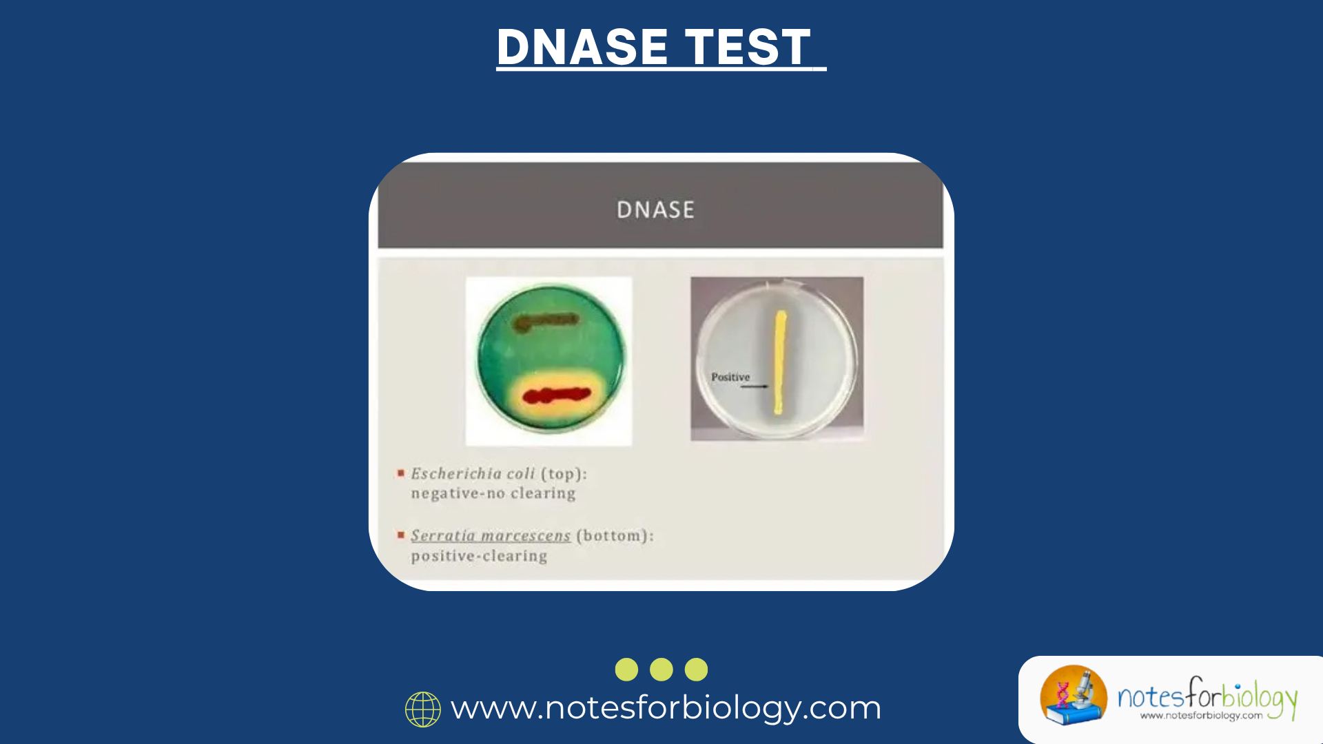 DNase Test - Best Biology Notes, Reference, Articles