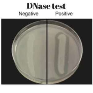 DNase Test - Best Biology Notes, Reference, Articles