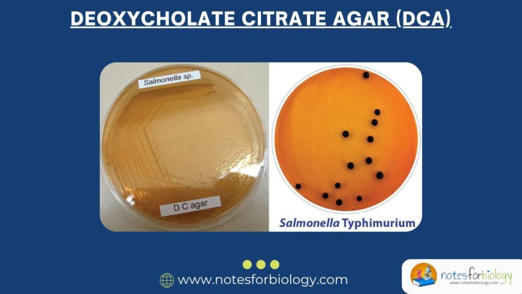 Giemsa stain: Principle, procedure, result - Best Biology...