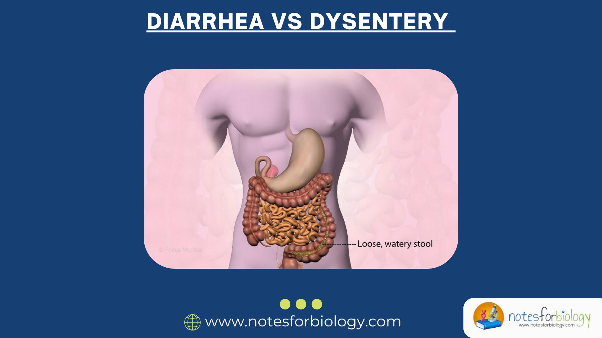 Diarrhea vs Dysentery - Best Biology Notes, Reference,..