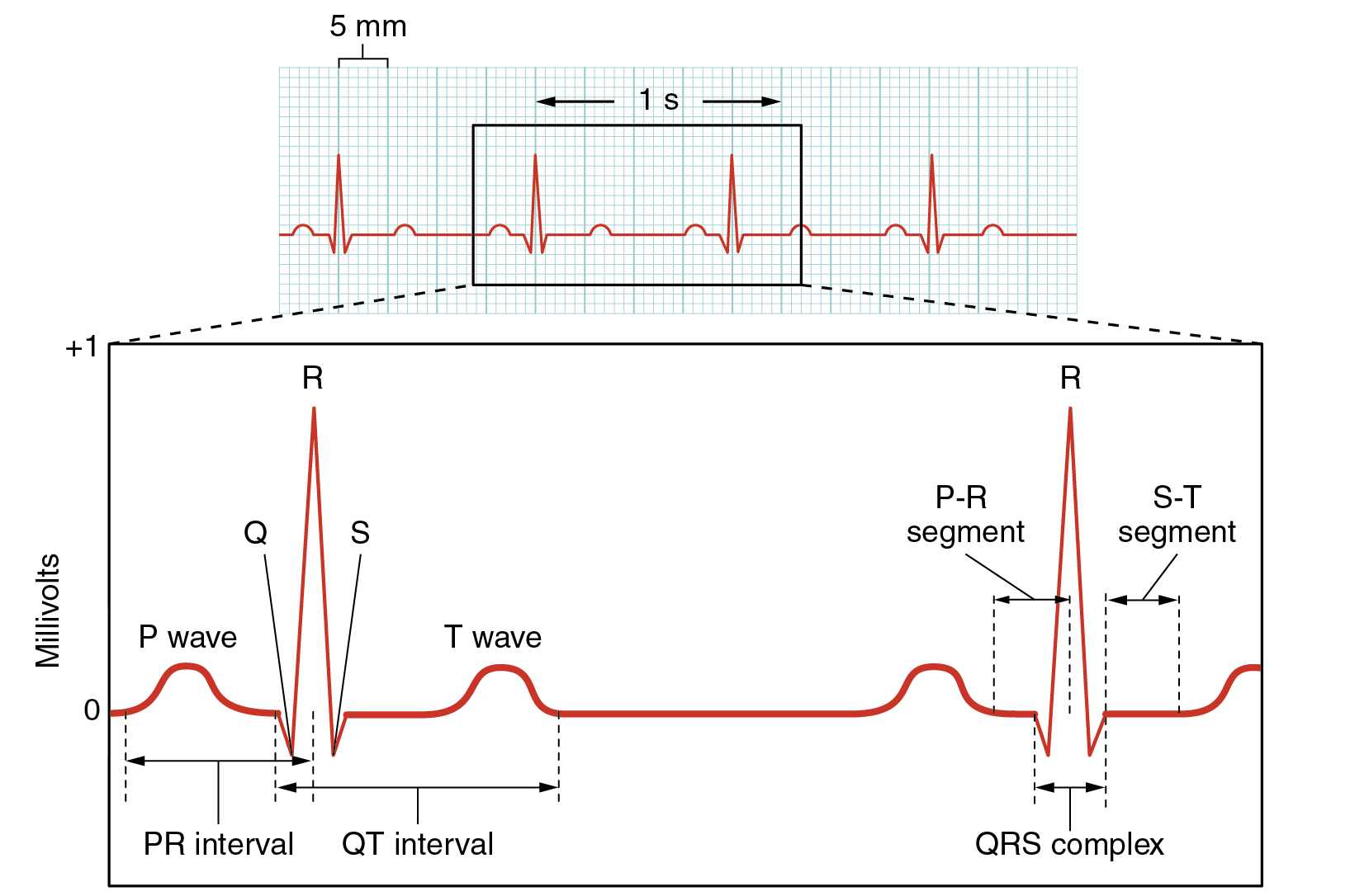 Electrocardiogram (ECG) - Best Biology Notes, Reference,...
