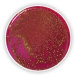 Endo Agar - Best Biology Notes, Reference, Articles