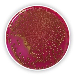 Endo Agar - Best Biology Notes, Reference, Articles