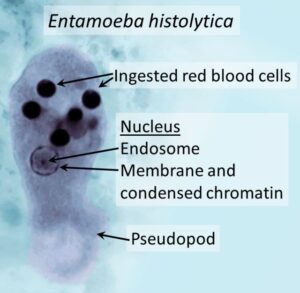 Entamoeba histolytica: Morphology, life cycle, Pathogenesis