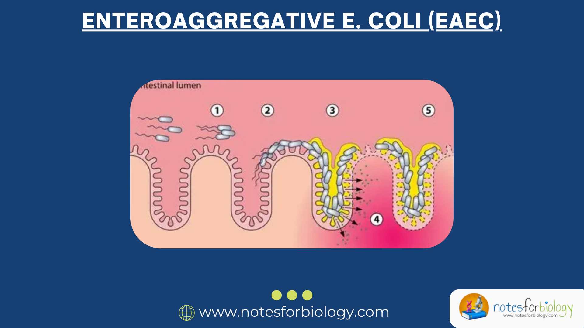 Enteroaggregative E. coli (EAEC) - Best Biology Notes,...