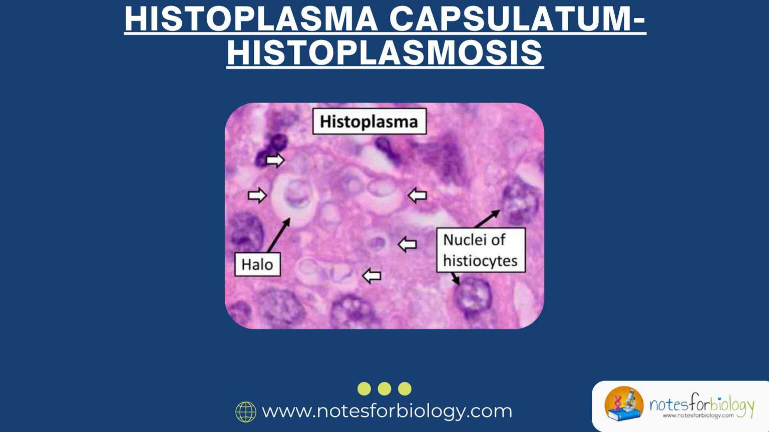Histoplasma capsulatum-Histoplasmosis and Types of...