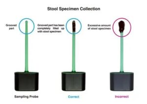 Stool Specimens: Collection and Transport. Best