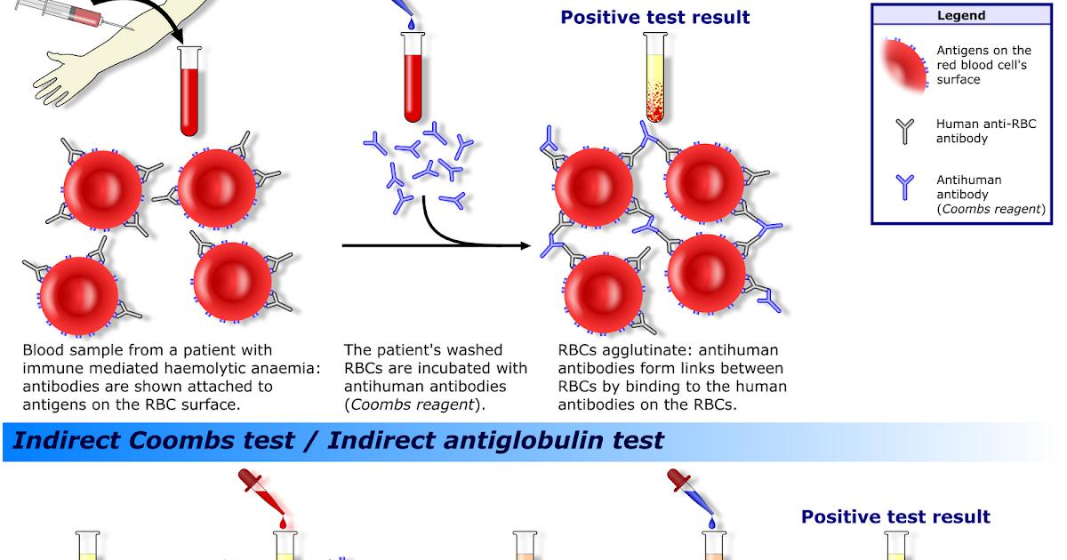 Coomb's Test - Best Biology Notes, Reference, Articles