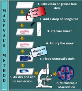 Capsule Stain: Principle, Procedure, and Result... Best