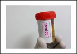 Stool Specimens: Collection and Transport. Best