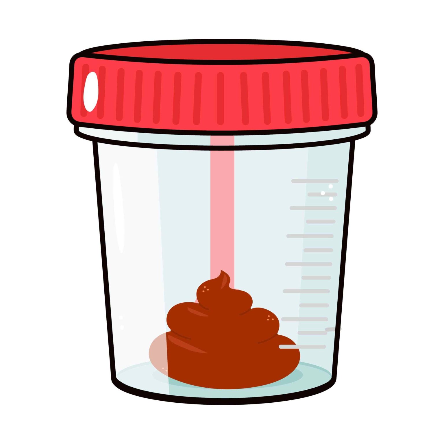 Stool Specimens: Collection and Transport. Best