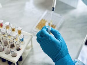 Complement Fixation Test- Principle, Procedure, Results