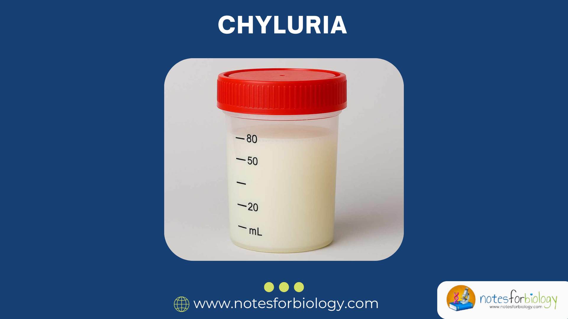 Chyluria: Causes, Prevalence, Management, Treatments - Best